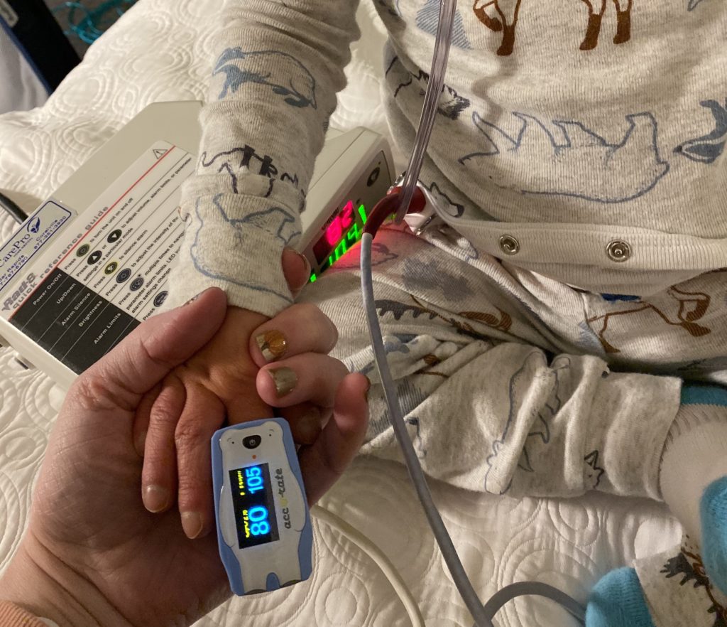 Pulse Ox Alarms - 8 Ways to Confirm If The Annoying Beeping is Valid